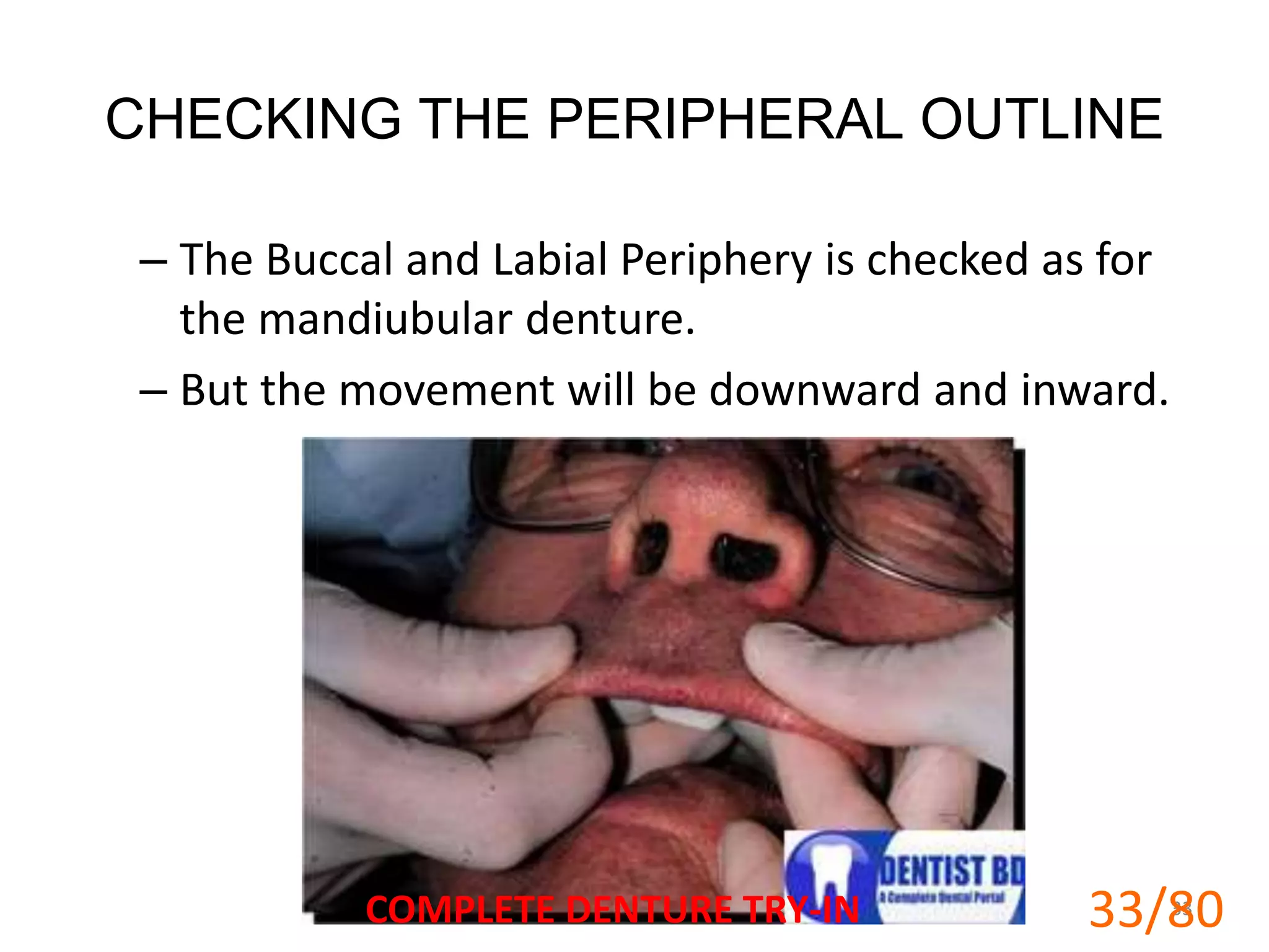 Complete Denture Try In | PPTX