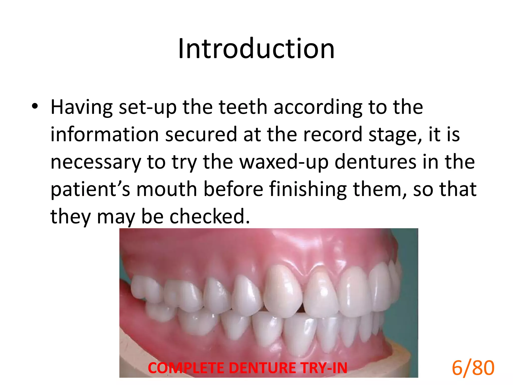 Complete Denture Try In | PPTX
