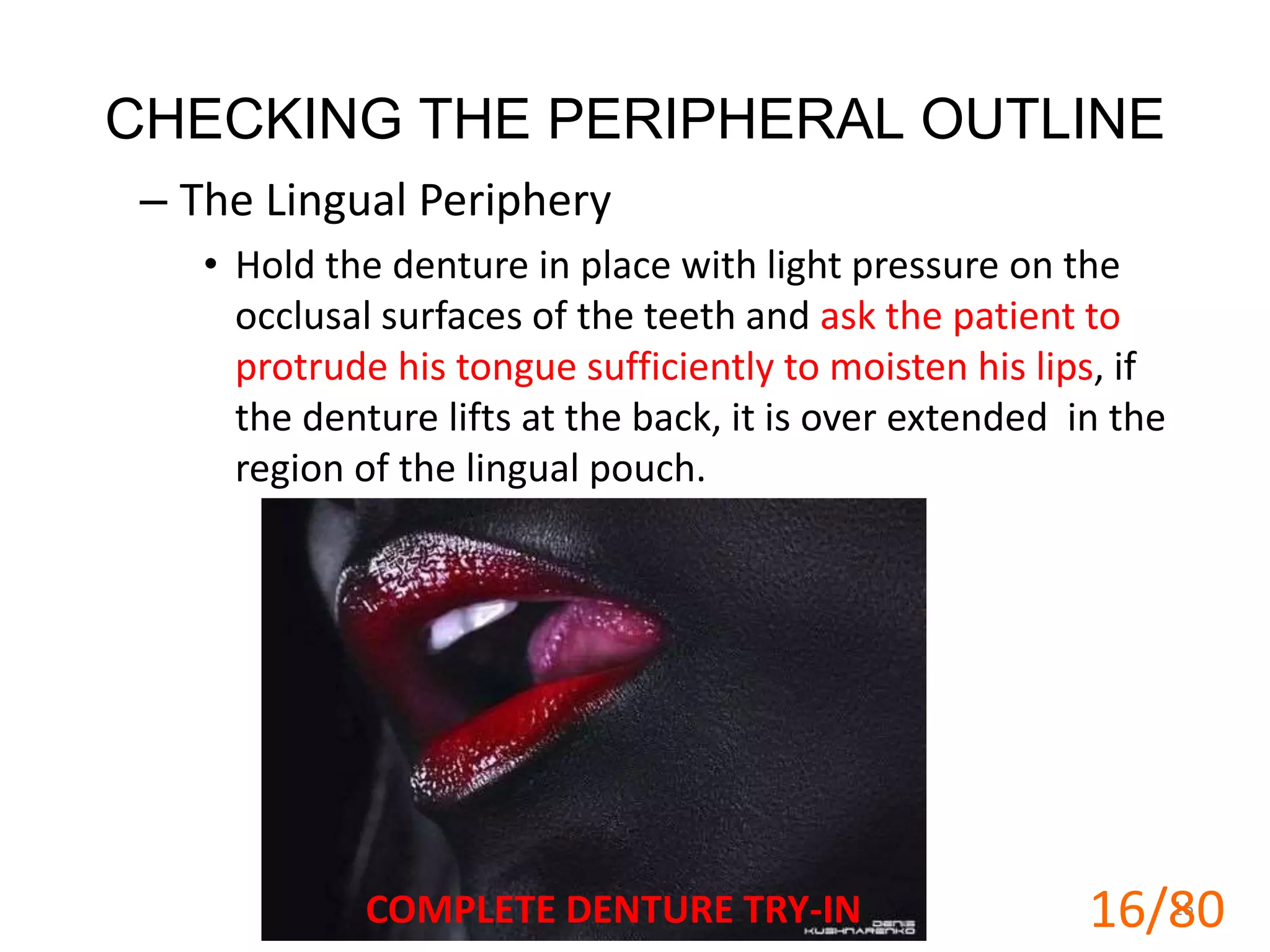 Complete Denture Try In