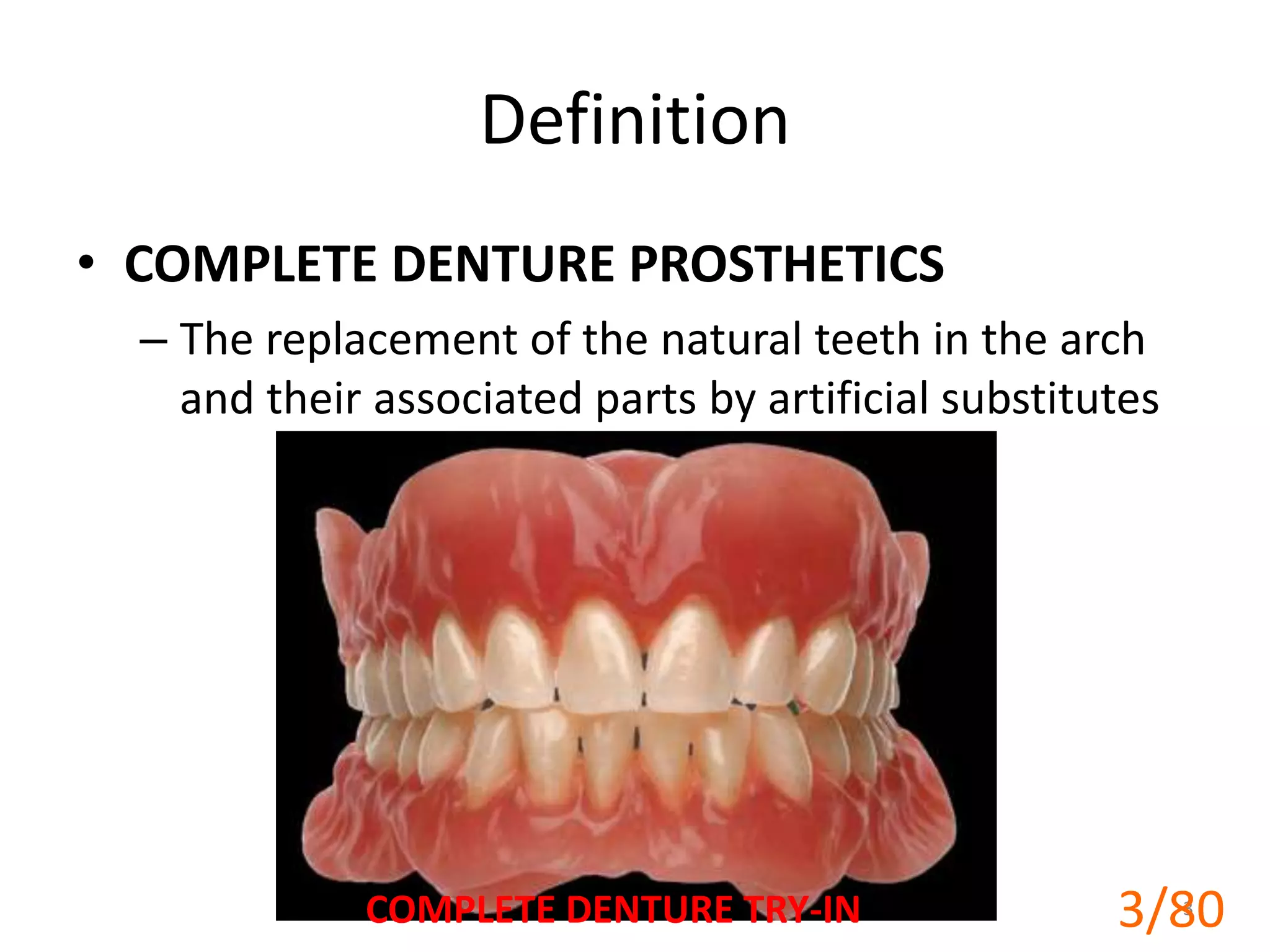 Complete Denture Try In