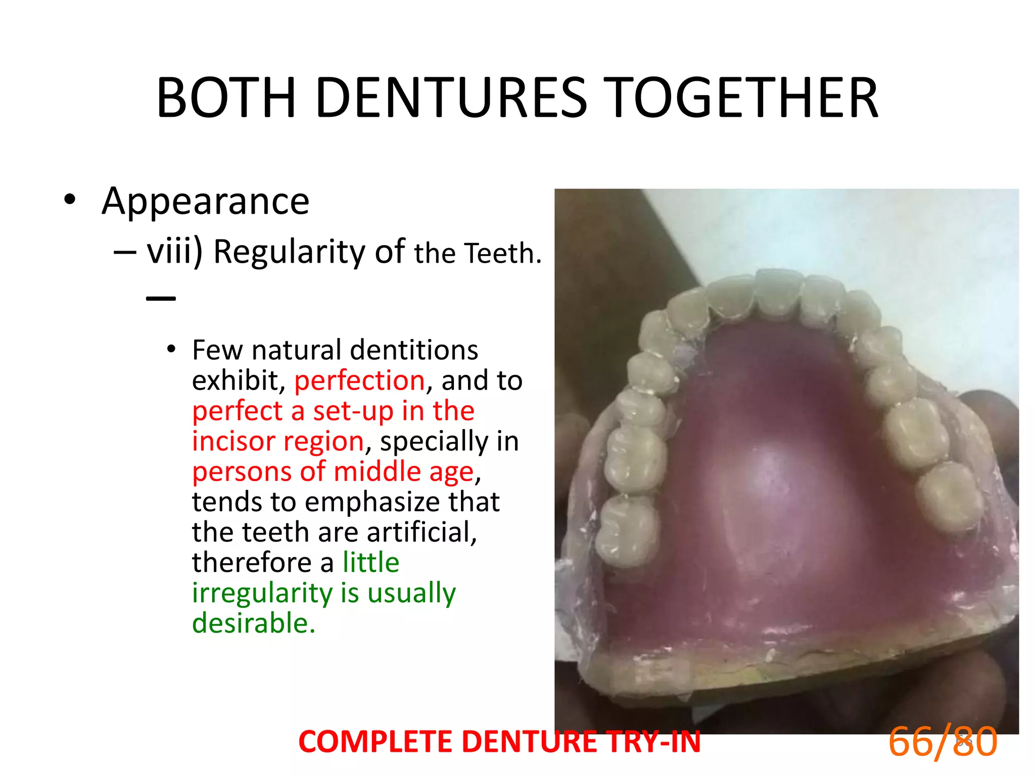 Complete Denture Try In