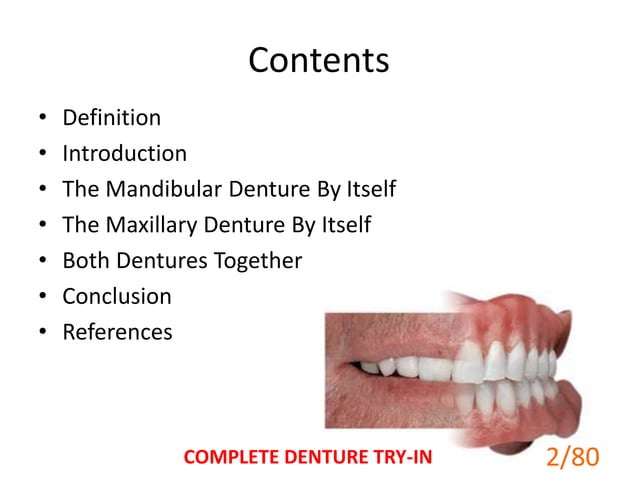 Complete Denture Try In | PPTX
