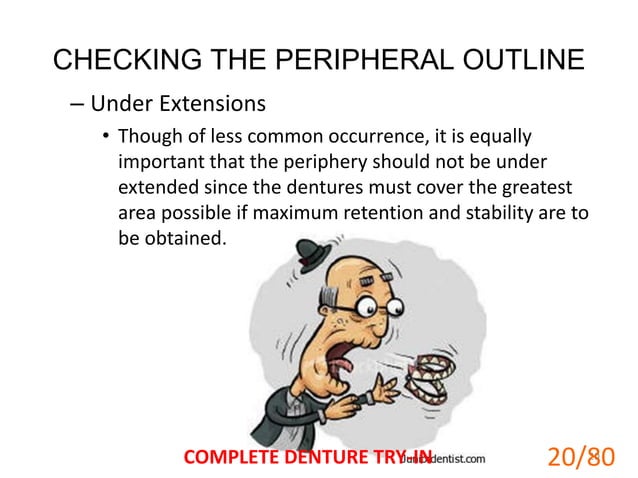 Complete Denture Try In | PPTX