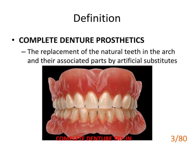 Complete Denture Try In | PPTX