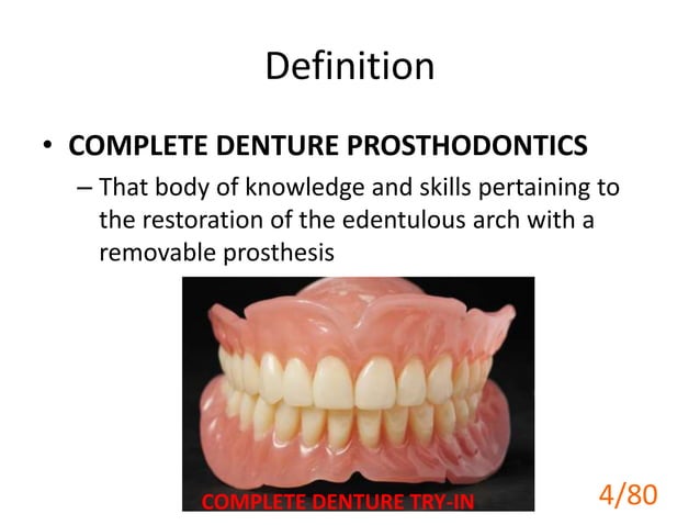 Complete Denture Try In | PPTX