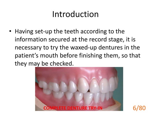 Complete Denture Try In | PPTX