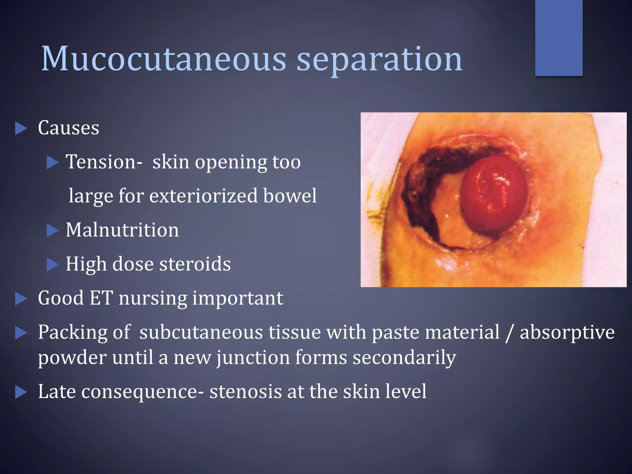 Stoma complications & its management | PPTX