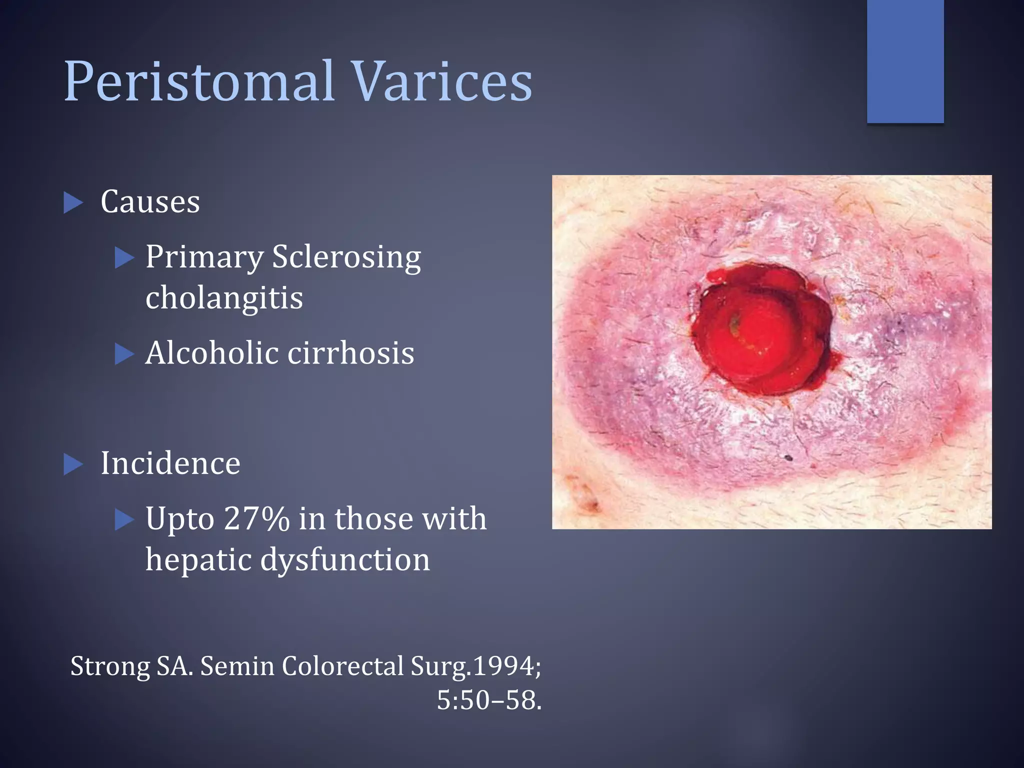 Stoma complications & its management | PPTX