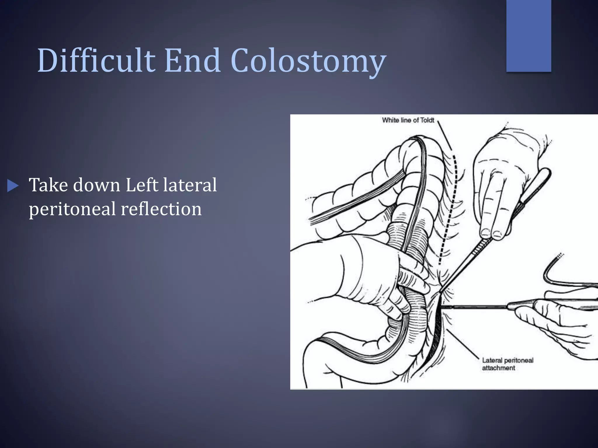 Stoma complications & its management | PPTX