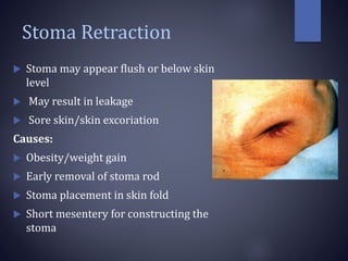 Stoma complications & its management | PPT