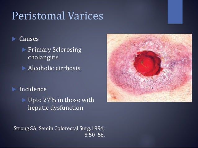 Stoma complications & its management