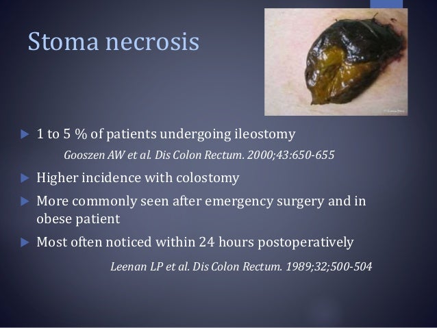 Stoma complications & its management