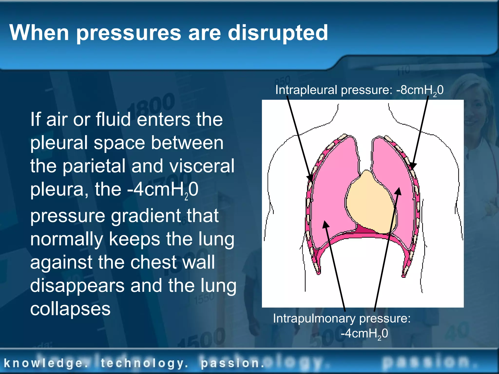 Managing chestdrainage | PPT