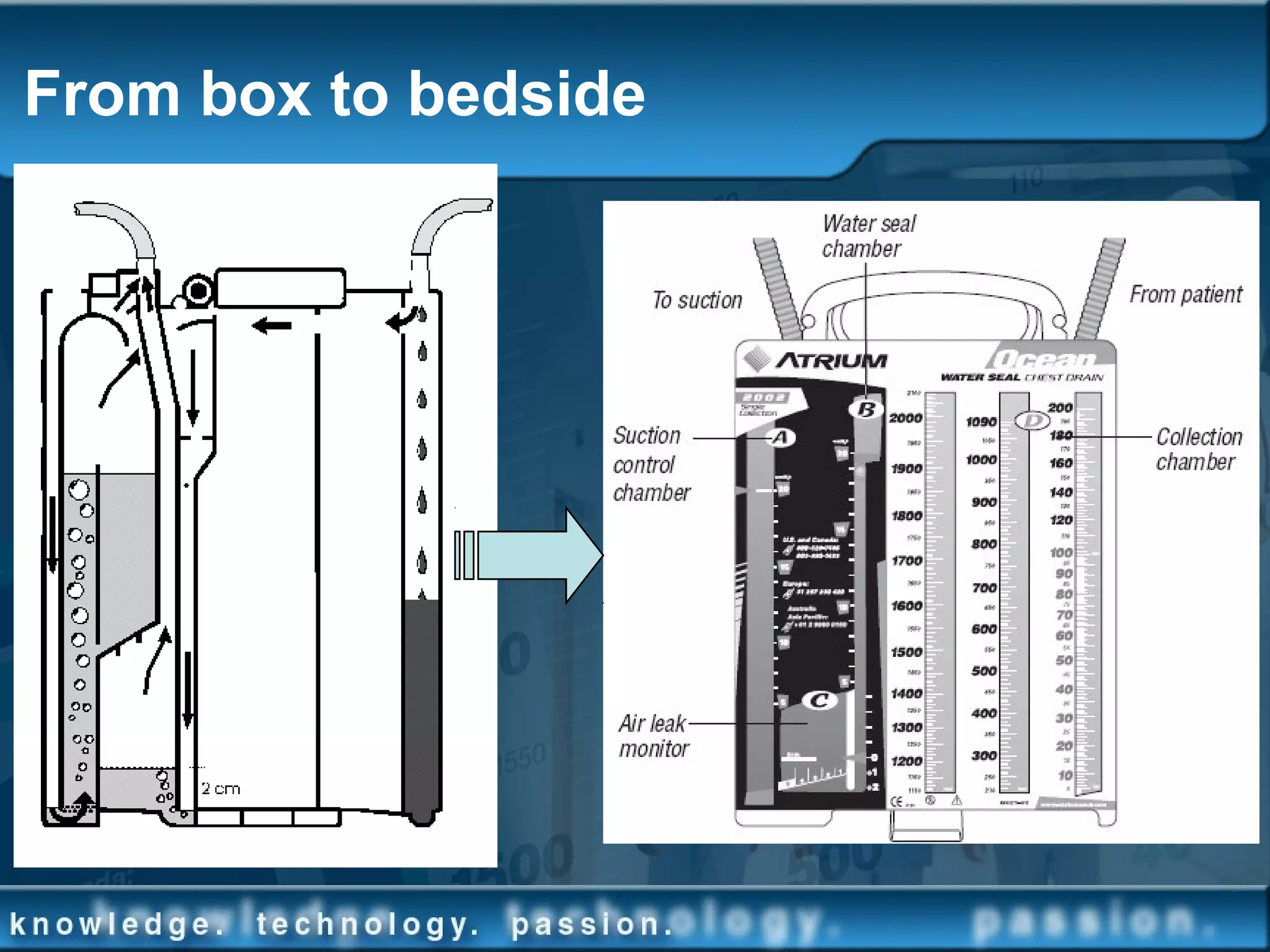 Managing chestdrainage | PPT