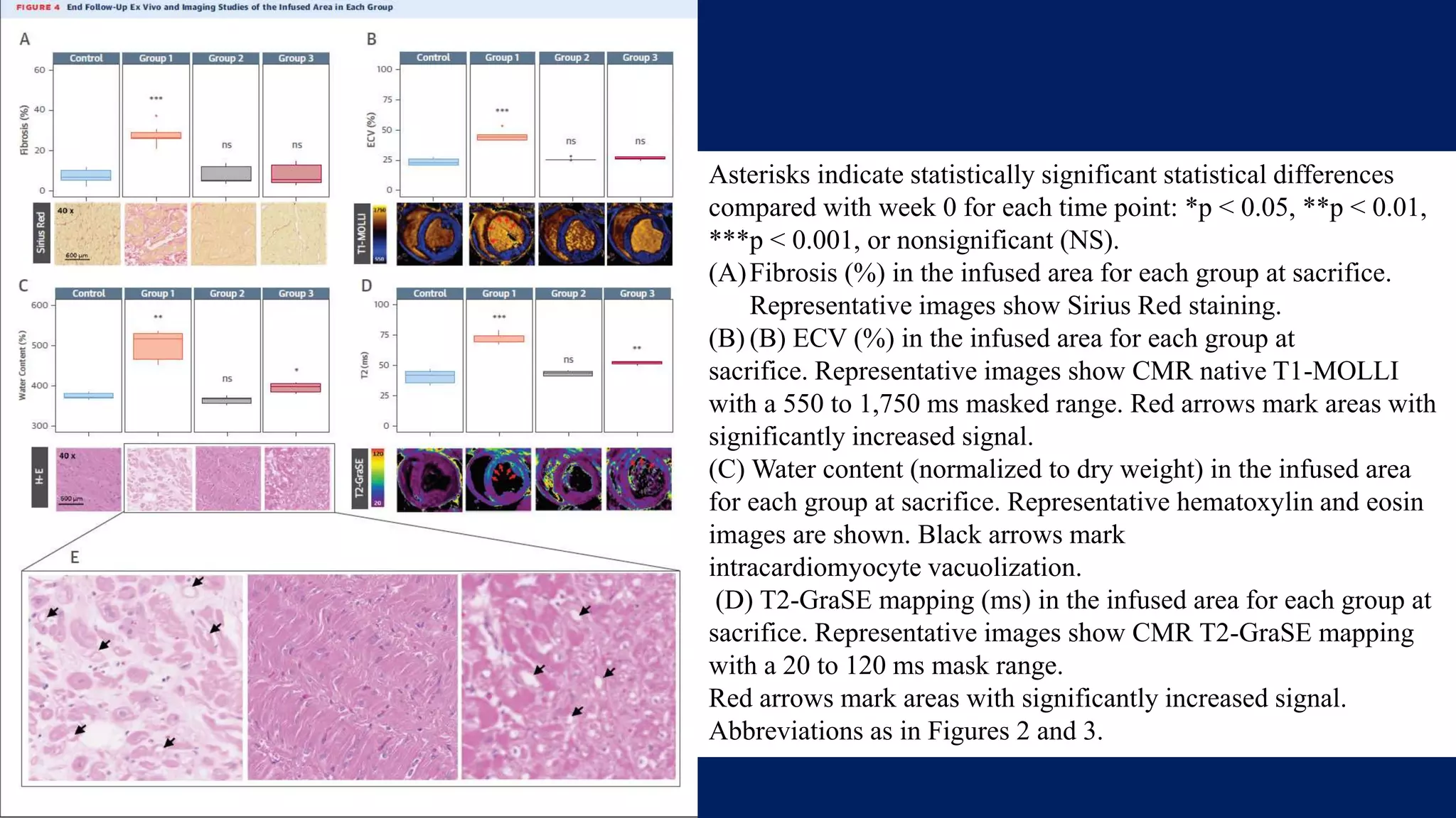 Year in cardiology imaging 2019 - CMR | PPTX