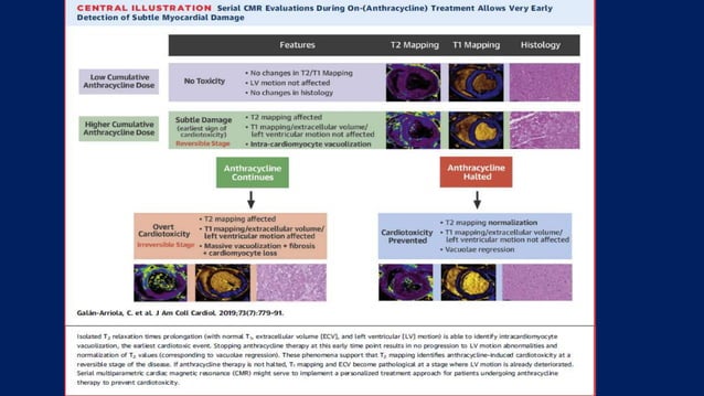 Year in cardiology imaging 2019 - CMR | PPT