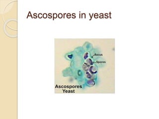 Yeast Slide