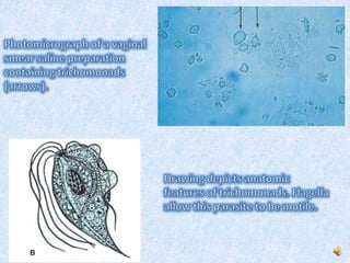 Yeast infection ppt | PPSX