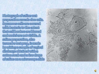 Yeast infection ppt | PPSX