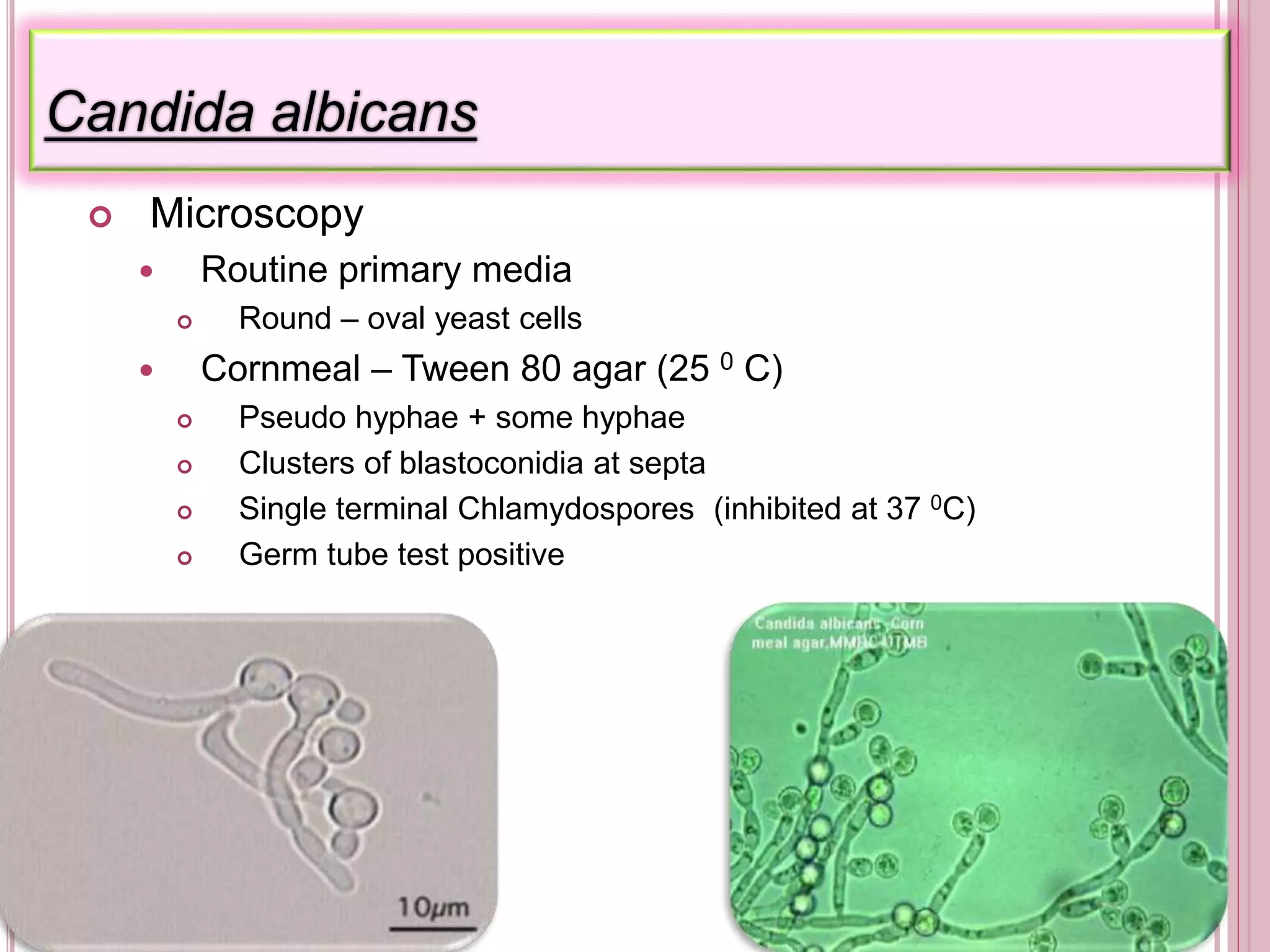 Identification of Yeasts & Candida species | PPTX