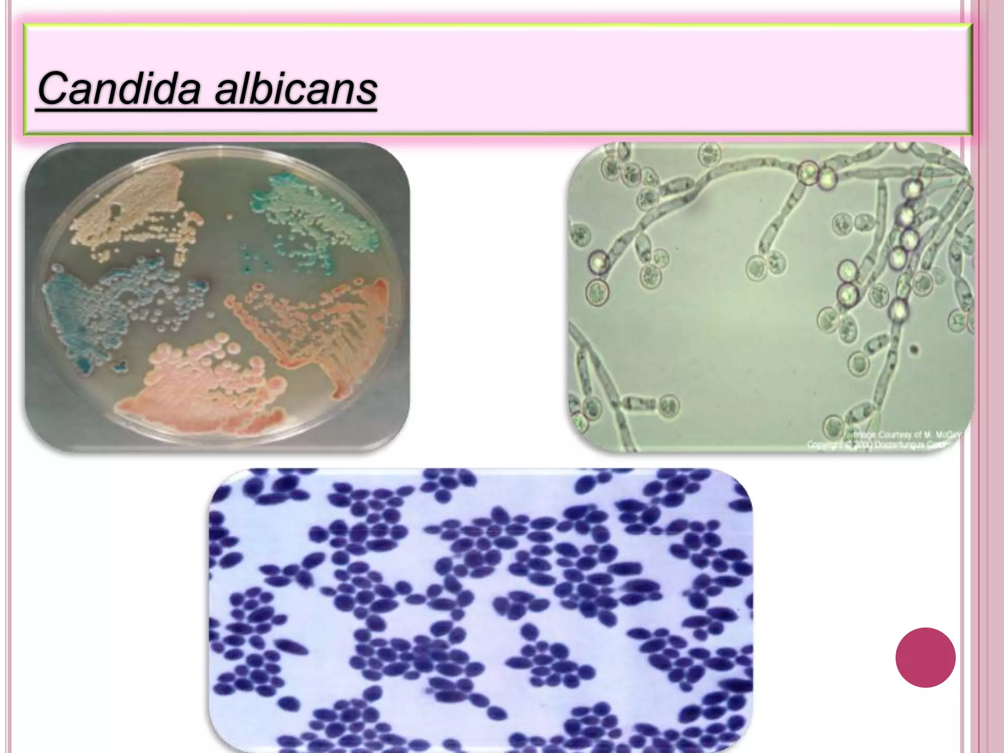 Identification of Yeasts & Candida species | PPTX