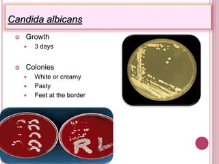 Identification of Yeasts & Candida species | PPTX