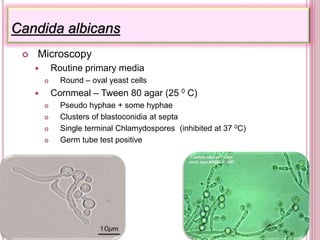 Identification of Yeasts & Candida species | PPTX