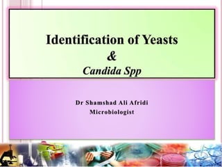 Identification of Yeasts & Candida species | PPTX
