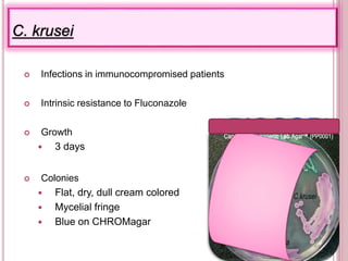 Identification of Yeasts & Candida species | PPTX