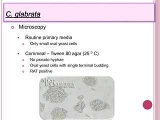 Identification of Yeasts & Candida species | PPTX