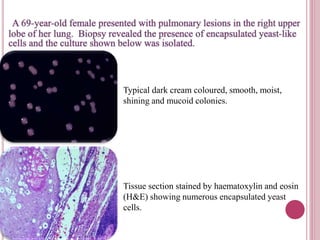 Identification of Yeasts & Candida species | PPTX | Skin and ...