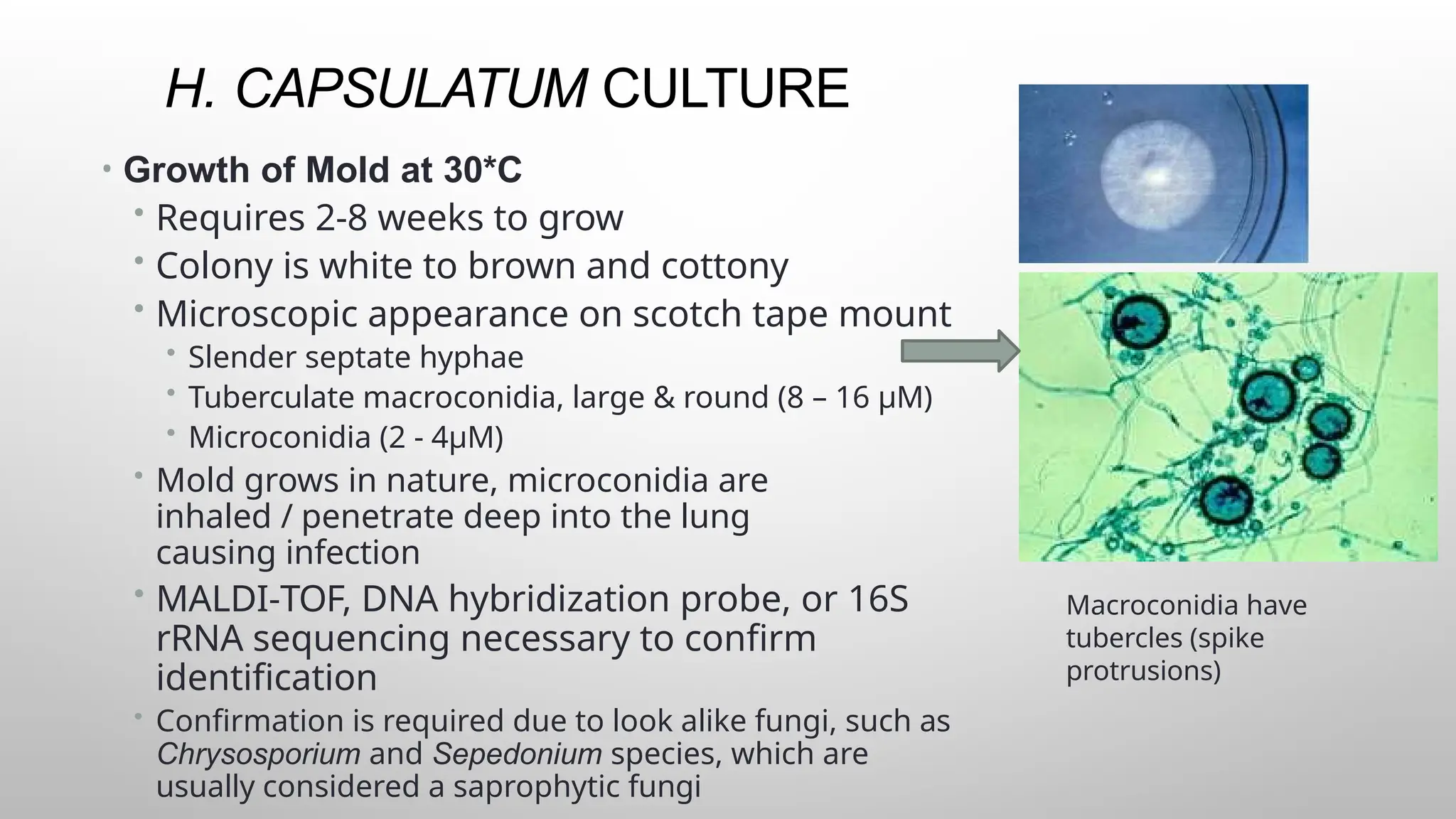 YEASTS AND DIMORPHIC FUNGI powerpoint ppt | PPT