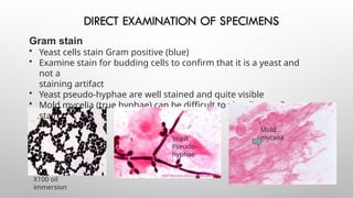 YEASTS AND DIMORPHIC FUNGI powerpoint ppt | PPTX