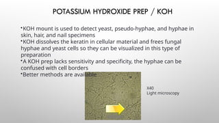 YEASTS AND DIMORPHIC FUNGI powerpoint ppt | PPTX