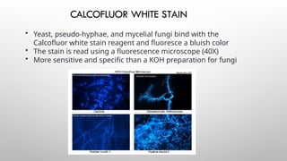 YEASTS AND DIMORPHIC FUNGI powerpoint ppt | PPTX