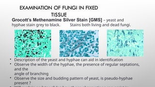 YEASTS AND DIMORPHIC FUNGI powerpoint ppt | PPTX