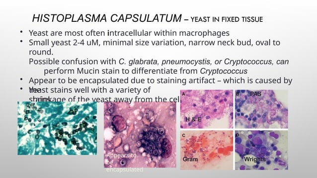 YEASTS AND DIMORPHIC FUNGI powerpoint ppt | PPT