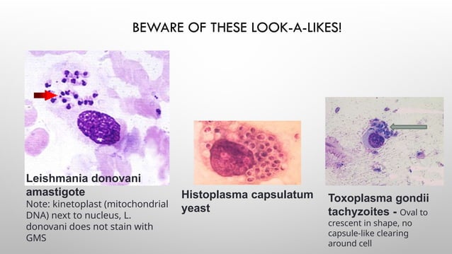 YEASTS AND DIMORPHIC FUNGI powerpoint ppt | PPT