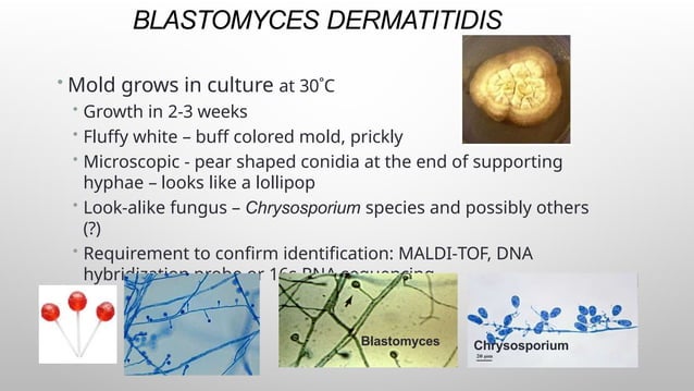 YEASTS AND DIMORPHIC FUNGI powerpoint ppt | PPT