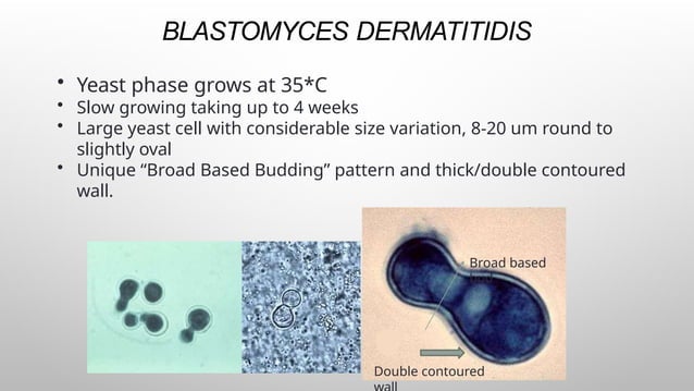 YEASTS AND DIMORPHIC FUNGI powerpoint ppt | PPT