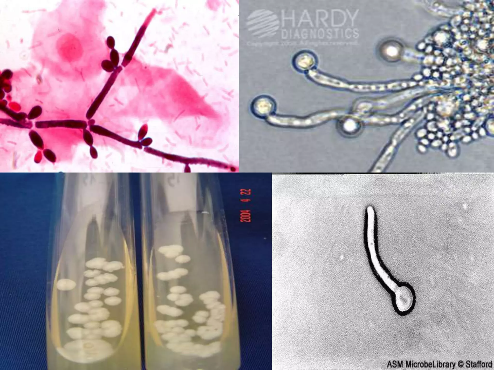Yeasts of medical importance - Candida and Cryptococcus | PPT