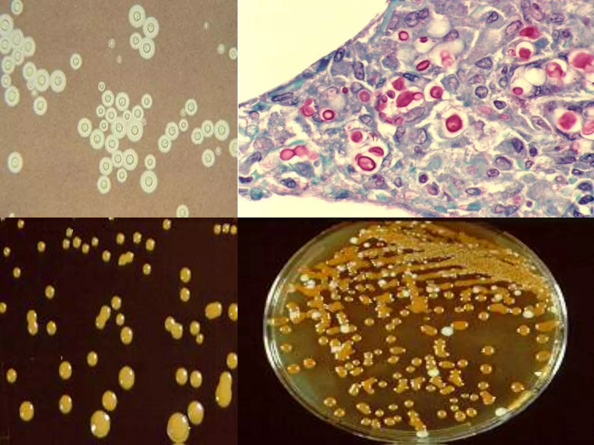 Yeasts of medical importance - Candida and Cryptococcus | PPT