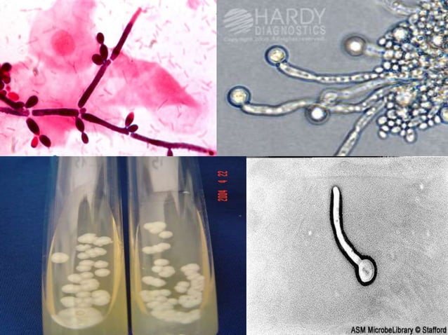 Yeasts of medical importance - Candida and Cryptococcus | PPT