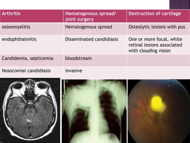 Yeasts of medical importance - Candida and Cryptococcus | PPT