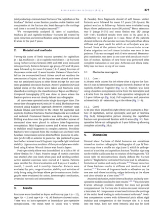 Internal fixation of fractures of the capitellum and trochlea ...