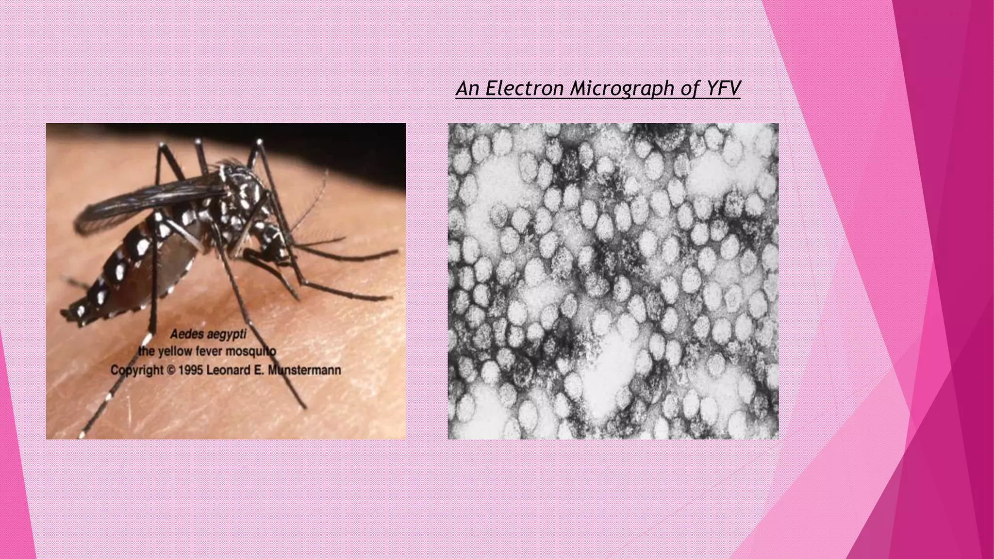 Yellow fever presentation | PPTX