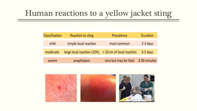 Yellow jacket sting: Inflammation and natural remedy
