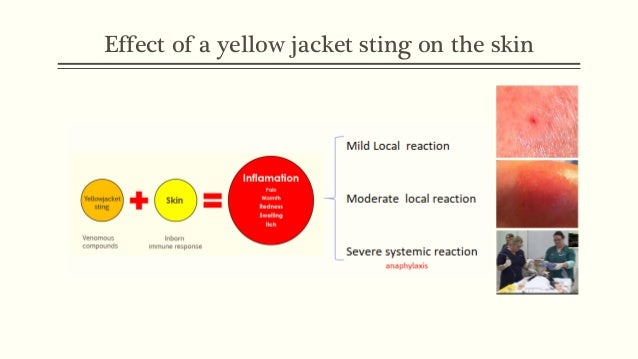 Yellow jacket sting: Inflammation and natural remedy