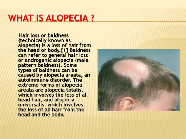 Reverse Traction Alopecia with arganrain - ReGrow Your Hair Naturally | PPT