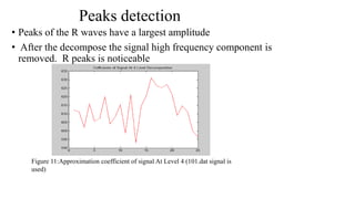 detectıon of dıseases usıng ECG signal | PPT
